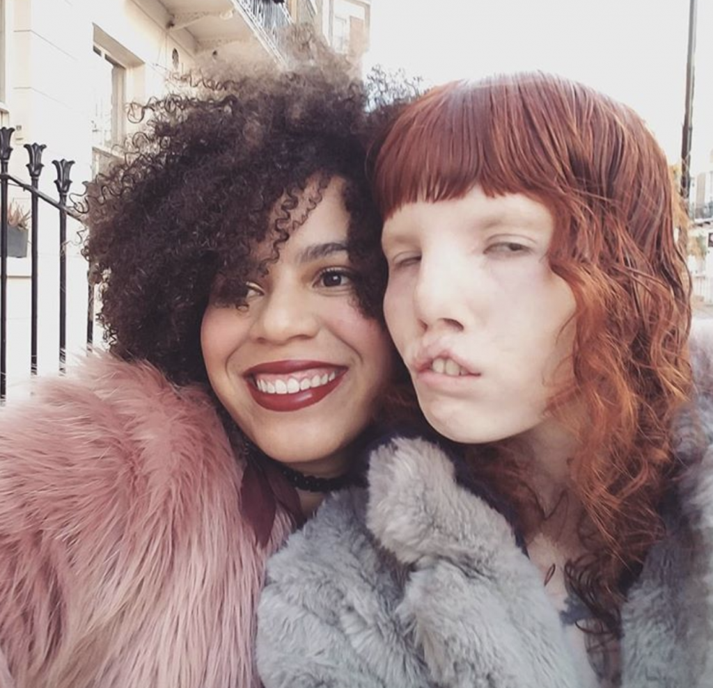 12 modelos poco comunes, con rasgos físicos realmente impactantes ...