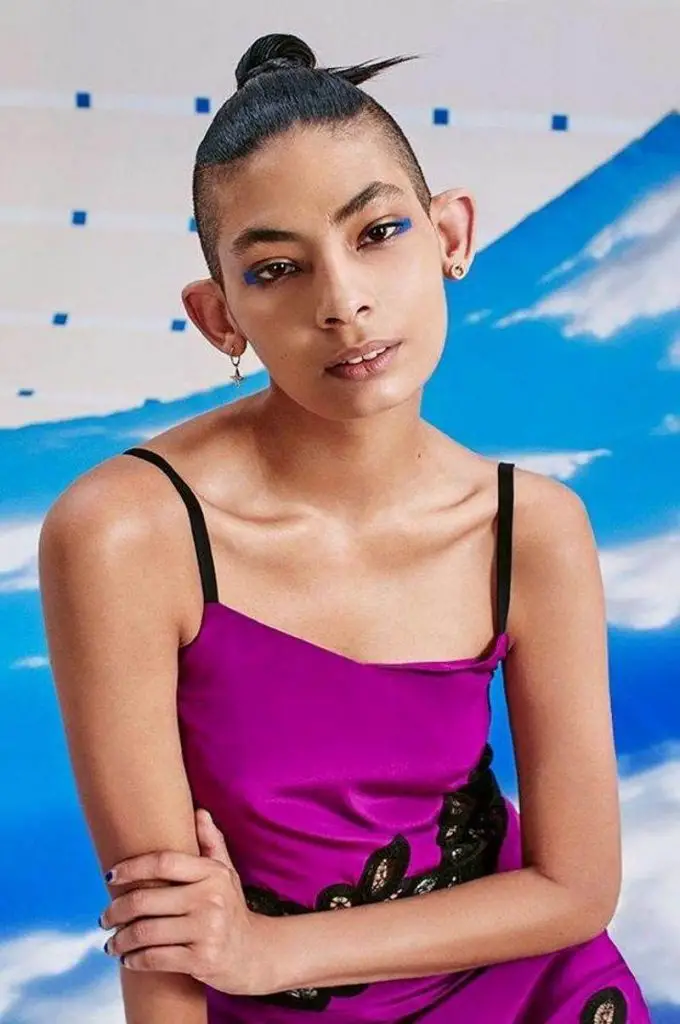 7 Modelos que convirtieron sus imperfecciones en “atracción” | Difundir.ORG