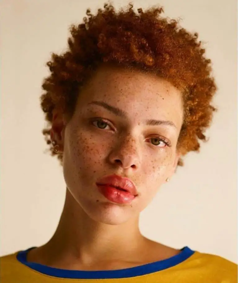 7 Modelos que convirtieron sus imperfecciones en “atracción” | Difundir.ORG