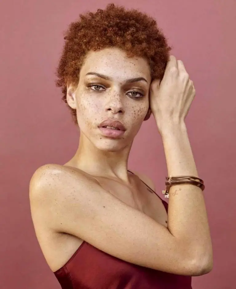 7 Modelos que convirtieron sus imperfecciones en “atracción” | Difundir.ORG