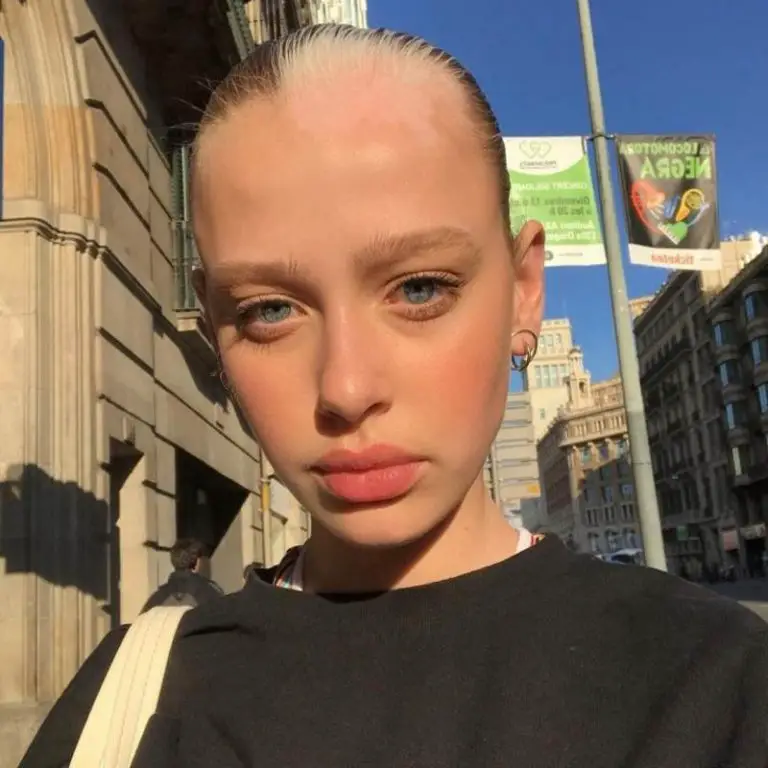 7 Modelos que convirtieron sus imperfecciones en “atracción” | Difundir.ORG