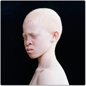 15 hermosas fotografías de Albinos que te dejarán sin palabras ...