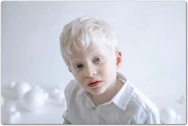 15 hermosas fotografías de Albinos que te dejarán sin palabras ...