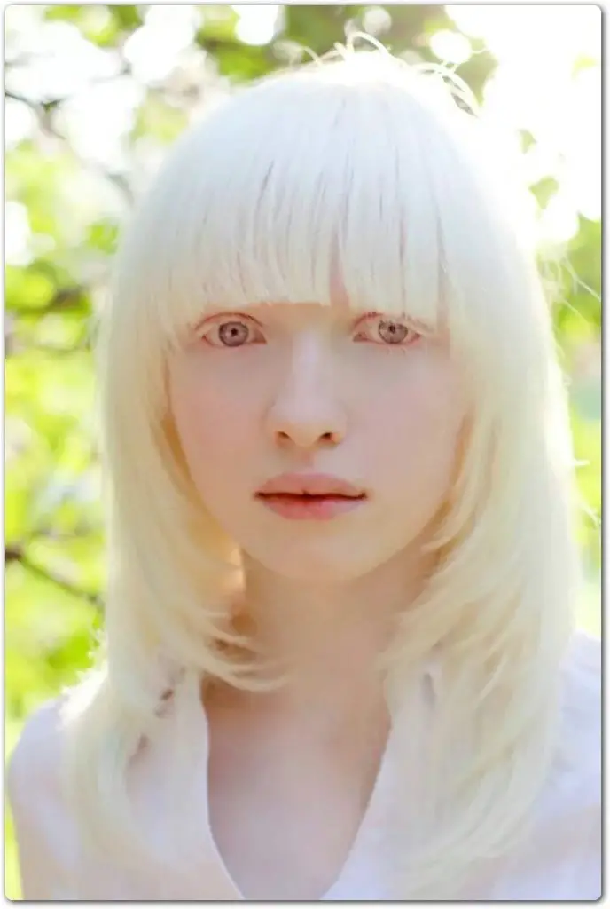 15 hermosas fotografías de Albinos que te dejarán sin palabras ...